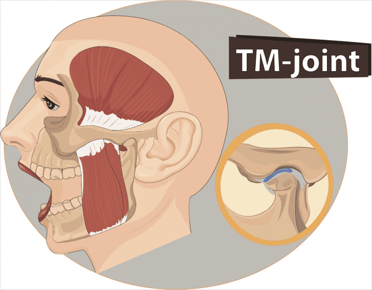 TMJ Dysfunction: How Your Jaw Works & How it’s Treated When it Doesn’t ...